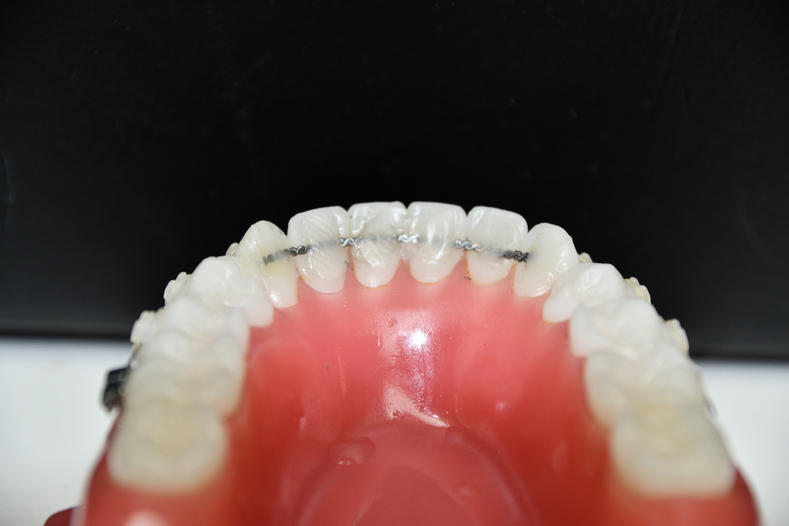 Traitements - SPRL Parorthod - Ln